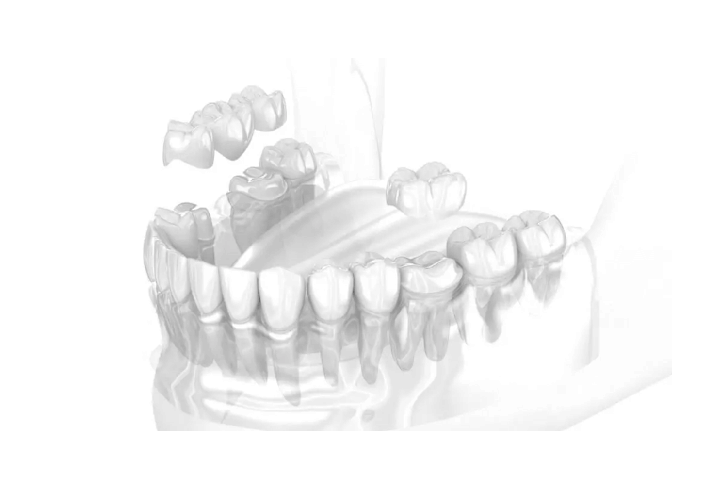 Zobu protēzes: kā tās var uzlabot jūsu dzīves kvalitāti? - Staburags.lv